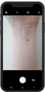 Cinapsis SmartReferrals | Connecting care for smarter referrals