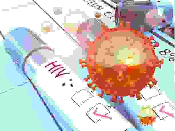 Human Immunodeficiency Virus