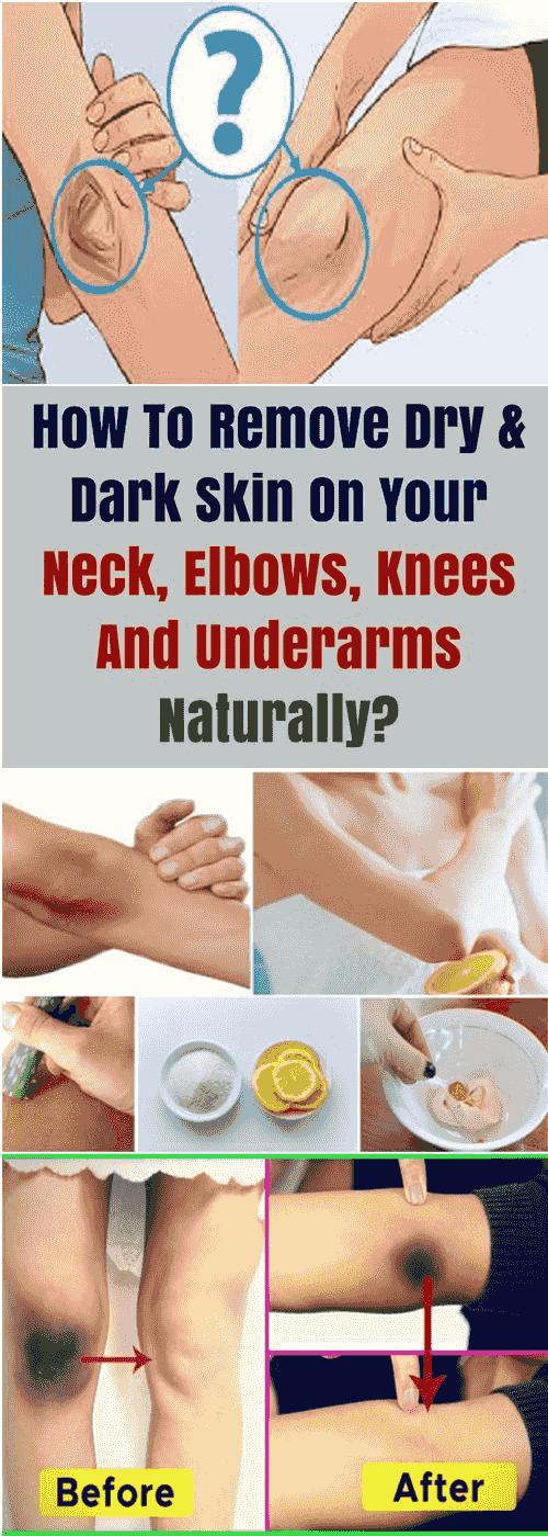 How to remove rainmeter skins