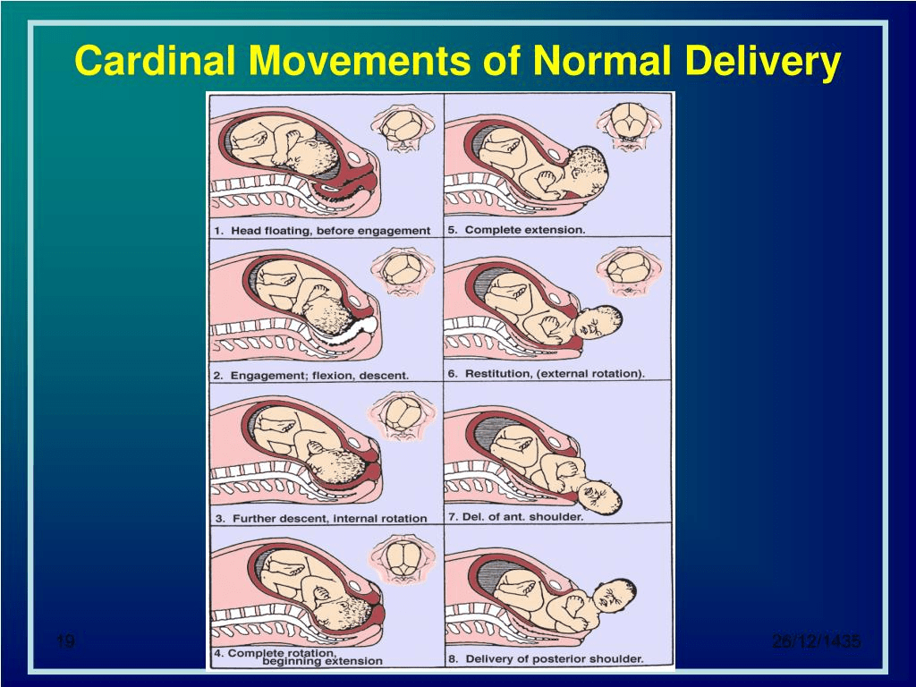 Cardinal movement of labor mnemonic