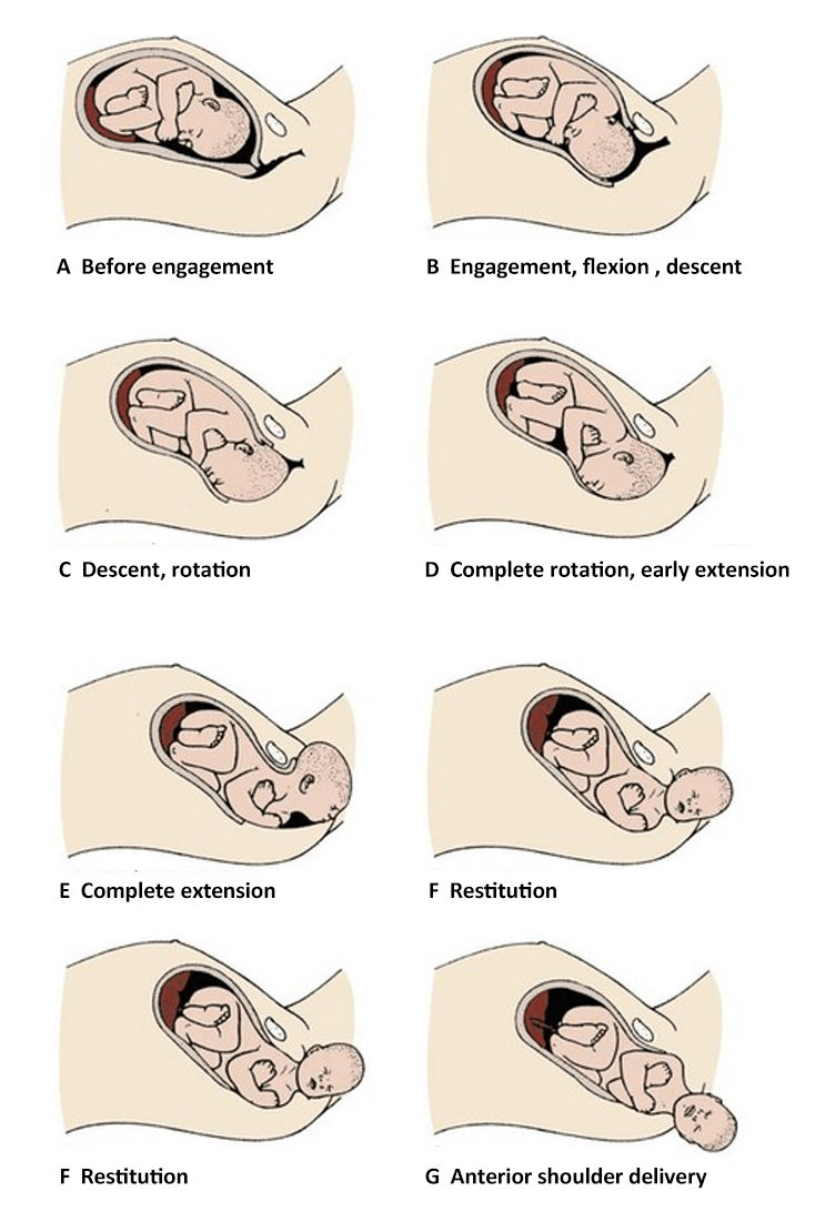 Cardinal movement of labor mnemonic