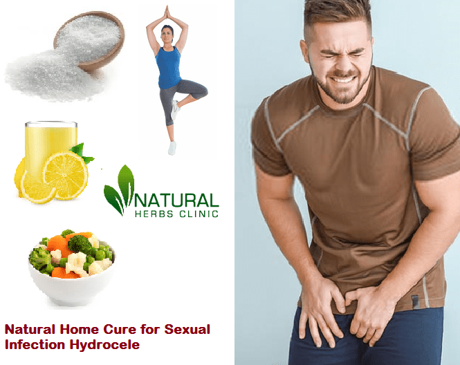 Natural Home Cure for Sexual Infection Hydrocele - Hydr...