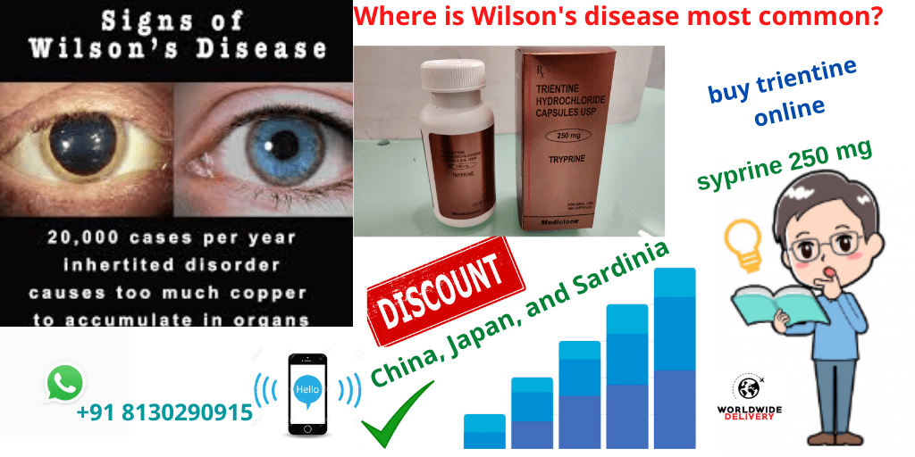 Wilson Disease Symptoms and Treatment - Health medicine