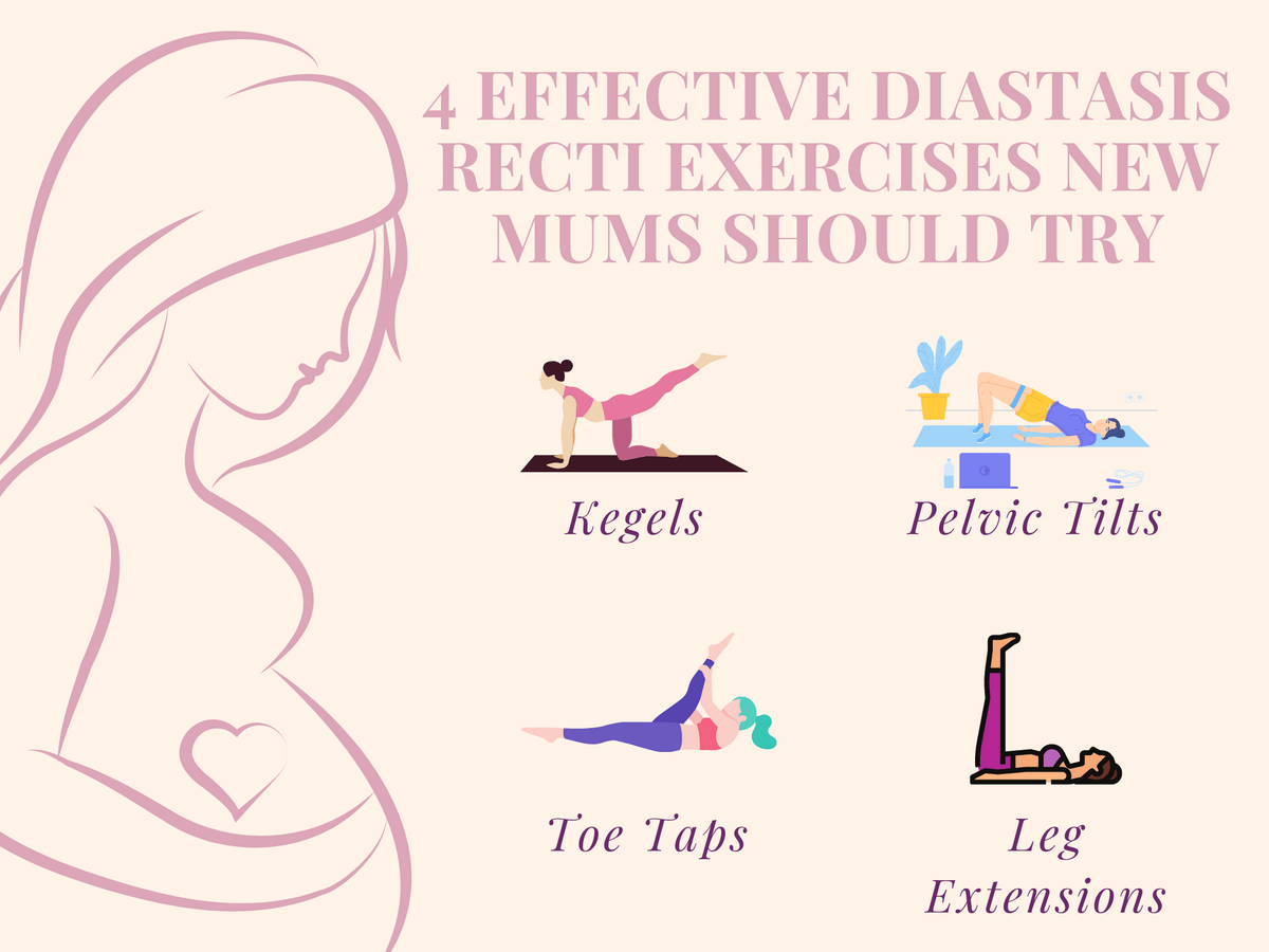How To Treat Divarication Of Recti Through Daily Exerci...