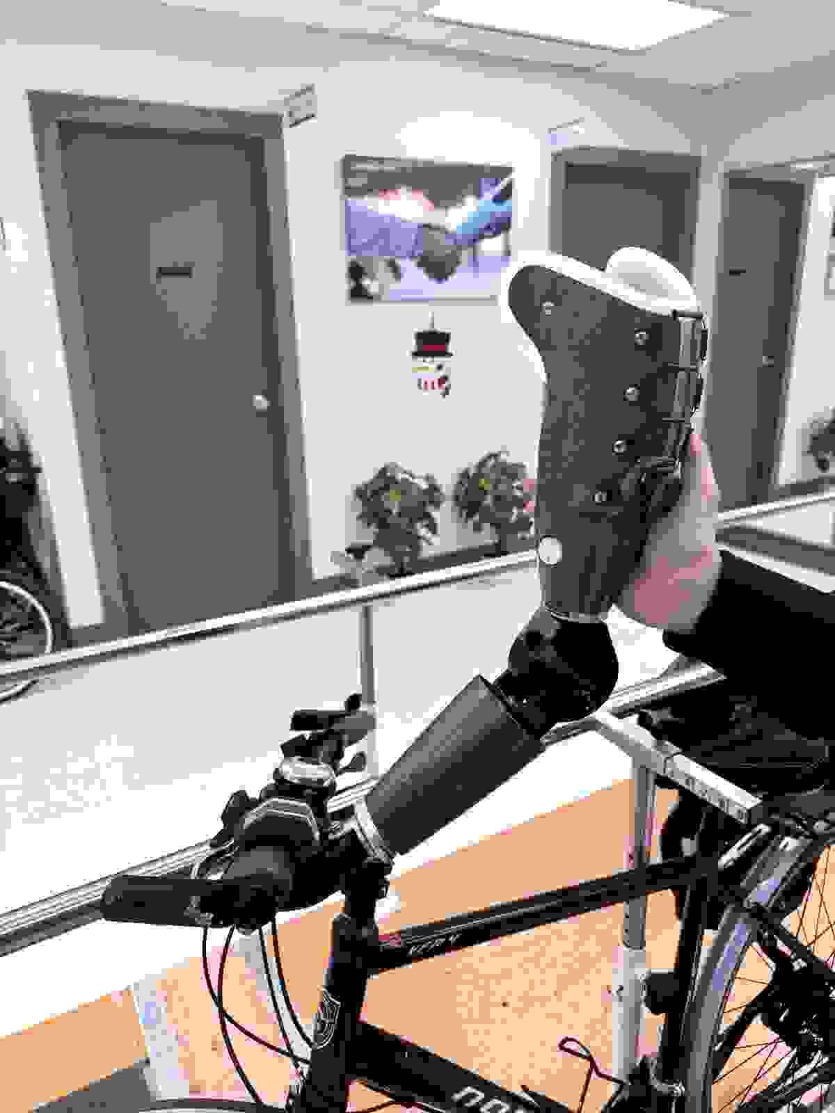 Bike Arm Prosthesis