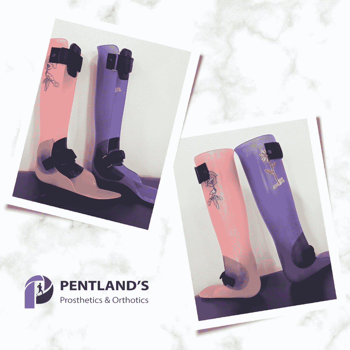 Personalized AFOs