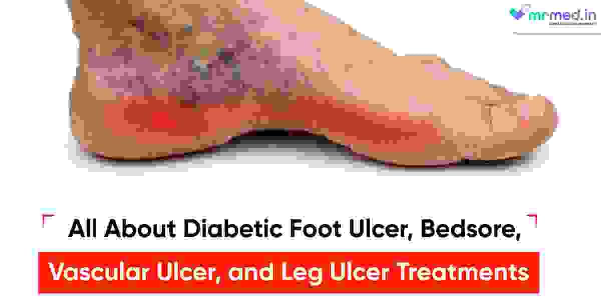 All About Diabetic Foot Ulcer, Bedsore, Vascular Ulcer,...