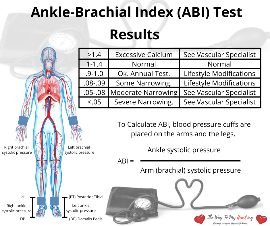 How Us Peripheral Artery Disease Diagnosed