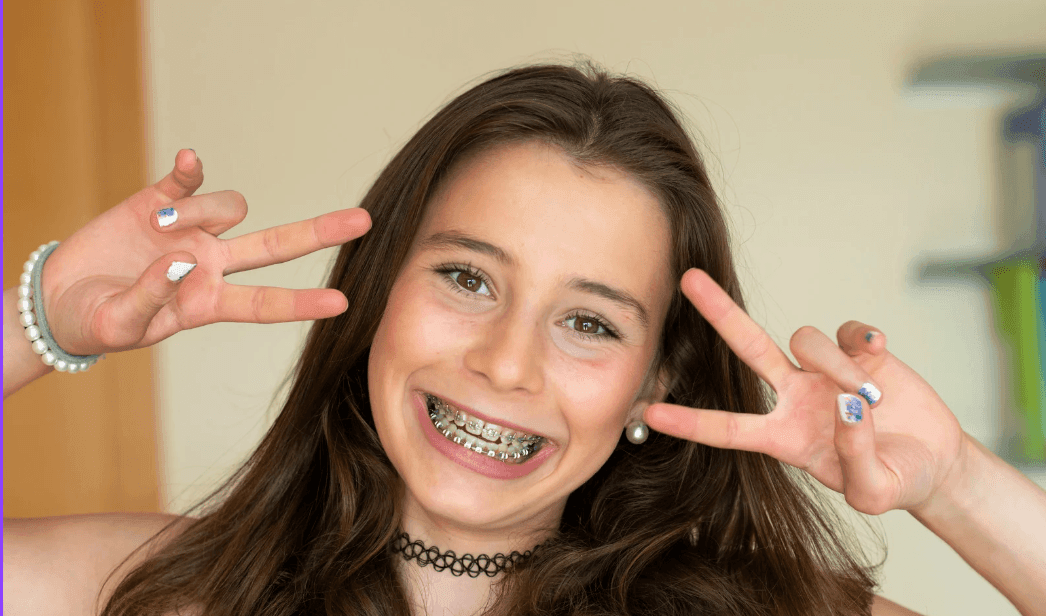 10 Things To Know About Your New Braces - Kid's Orthodo...