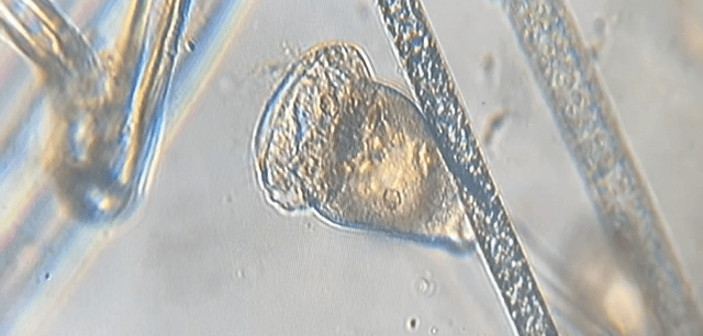 Observer le Plancton au Microscope