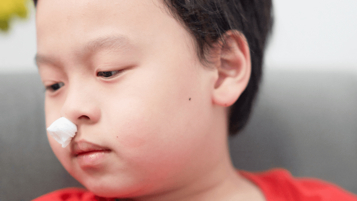 Nosebleed Myths Debunked: What Really Works to Curb Ble...
