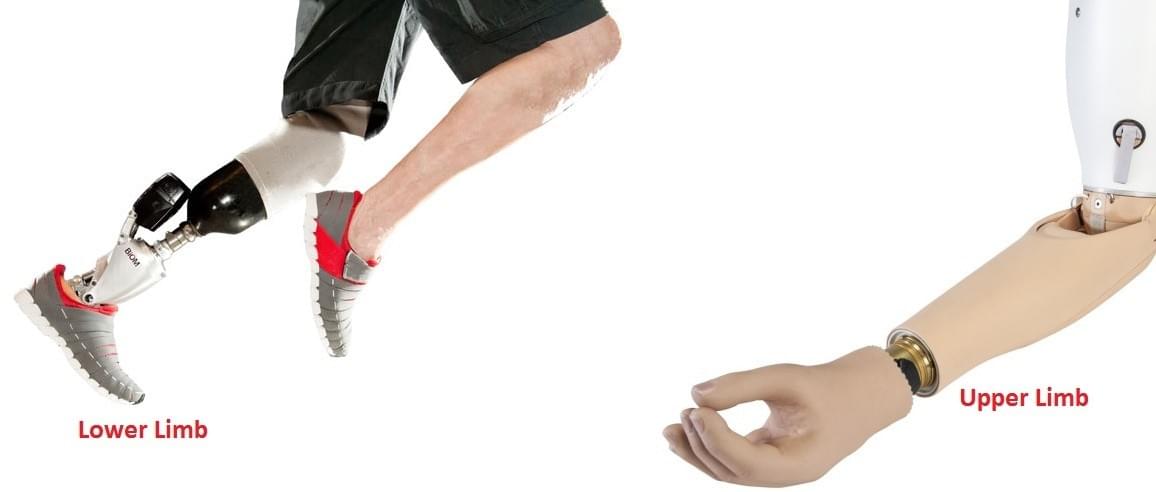 Prosthetics: How Technology is Revolutionizing Limb Rep...
