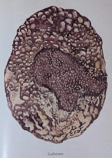 Inside Mora - A Very Strange Medical Book - Dr Stanley ...