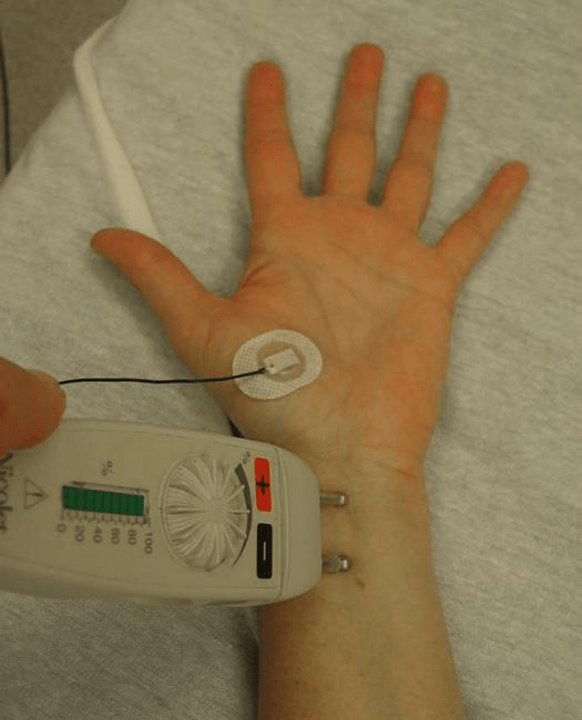 How painful is an emg nerve test