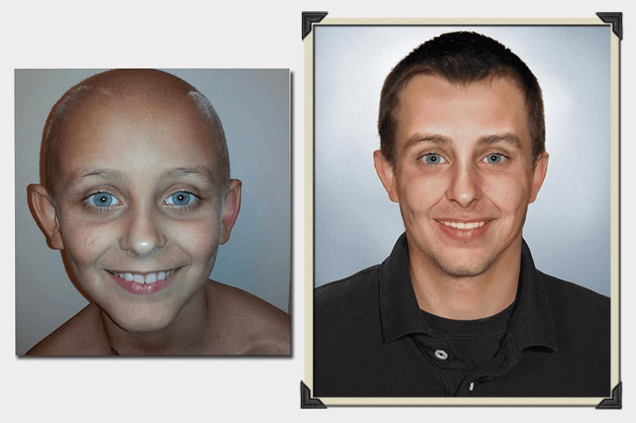 Face age progression morph app
