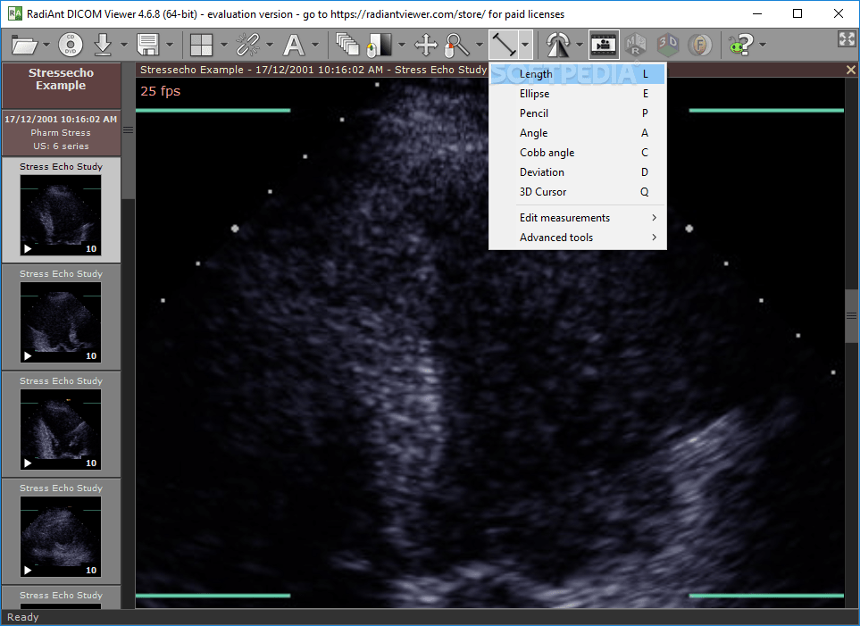 Radiant Dicom Viewer