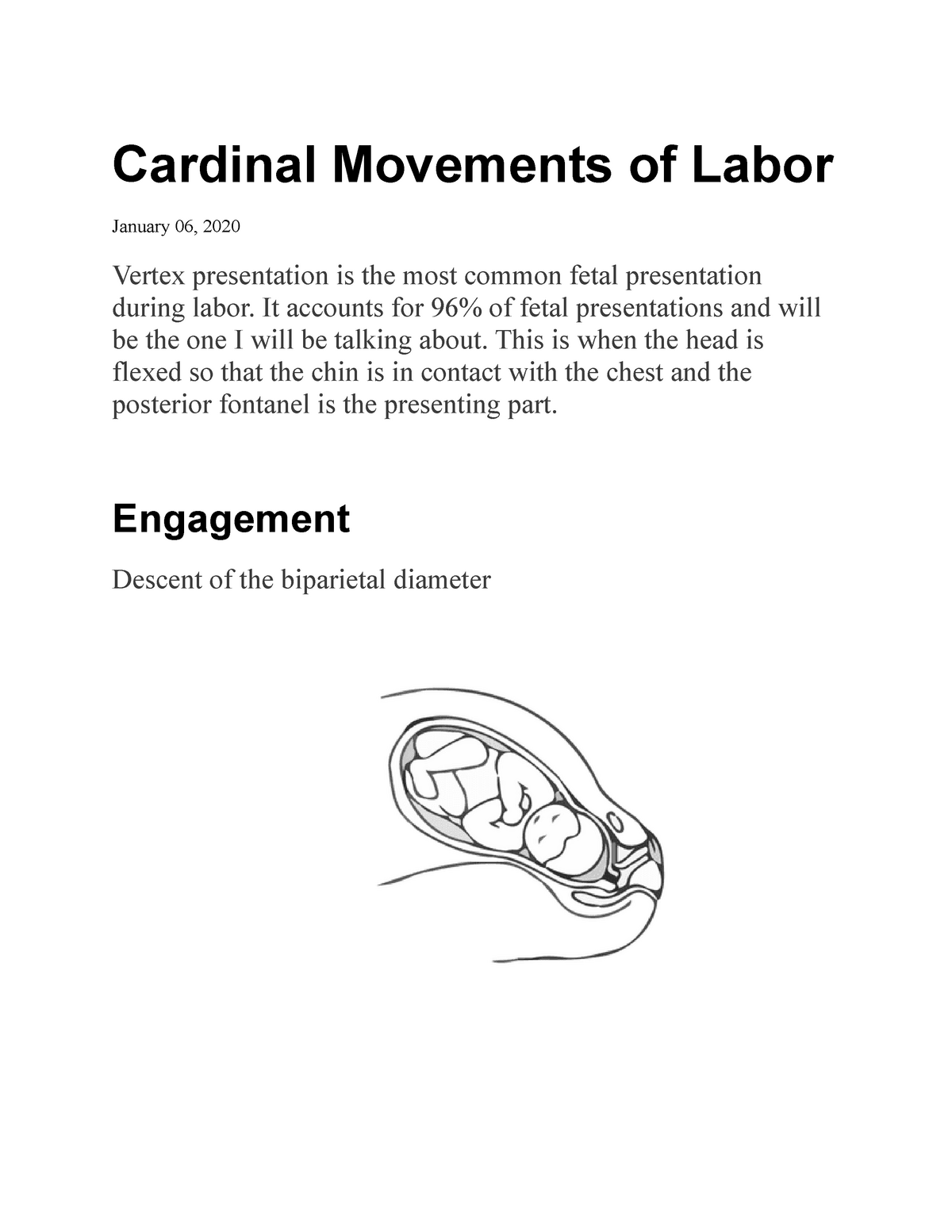 Cardinal movements of labor mneumonic