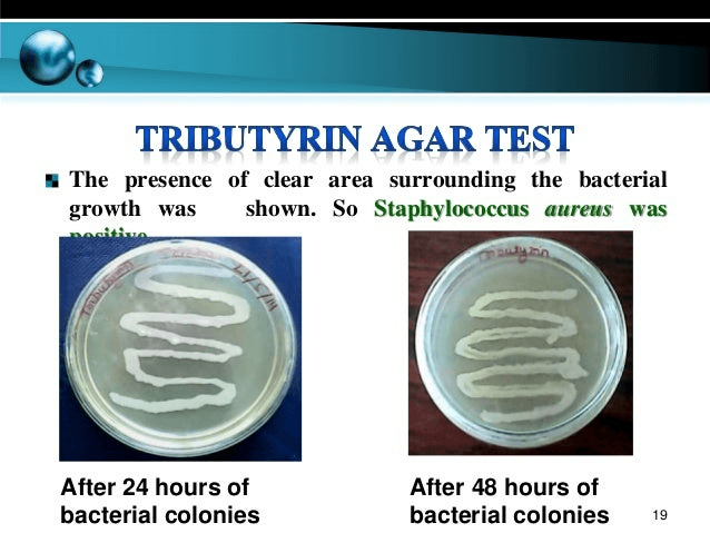 gelatinase test composition