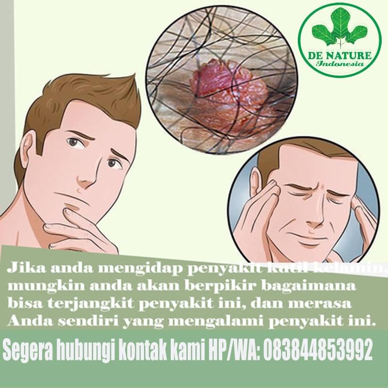 Obat-Penghilang-Daging Tumbuh Kutil Kelamin Minum Dan O...