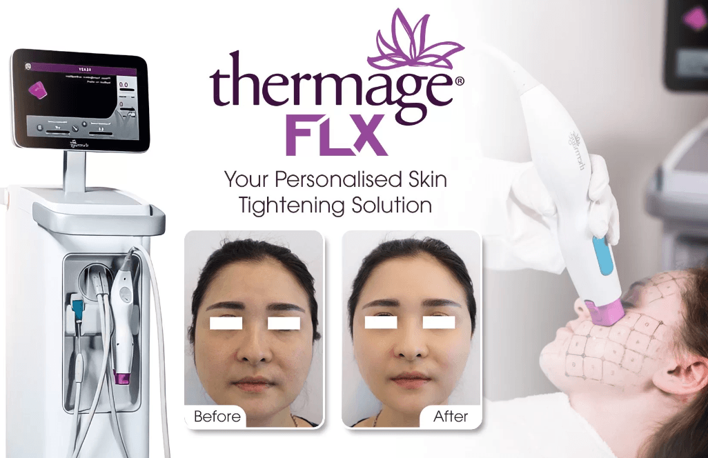 Thermage flx - Aesthetic Machines