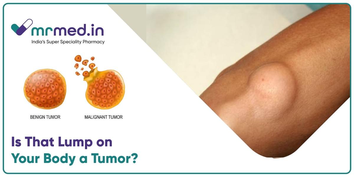 How to Know If a Tumor Is Benign or Malignant: A Comple...