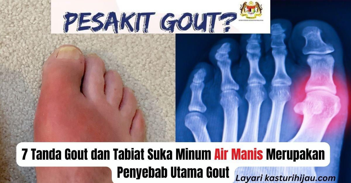 7 Tanda Gout dan Tabiat Suka Minum Air Manis Merupakan ...