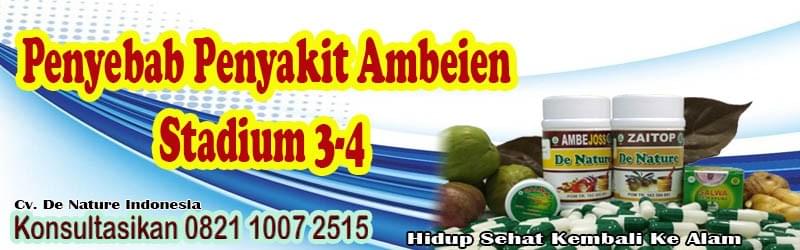 Penyebab Penyakit Ambeien Stadium 3-4 - Ambeien Stadium...