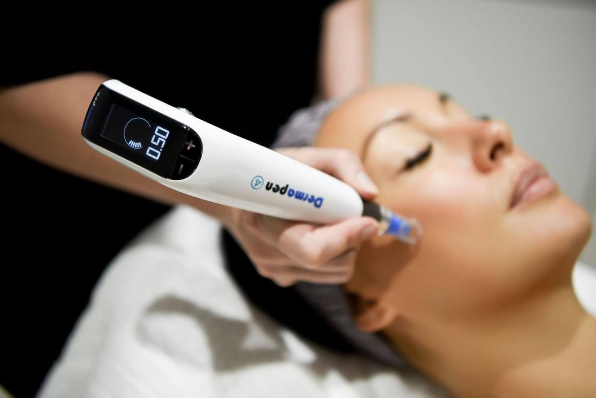 Does Dermapen Treatment Fade Fine Lines? - Dermapen Tre...