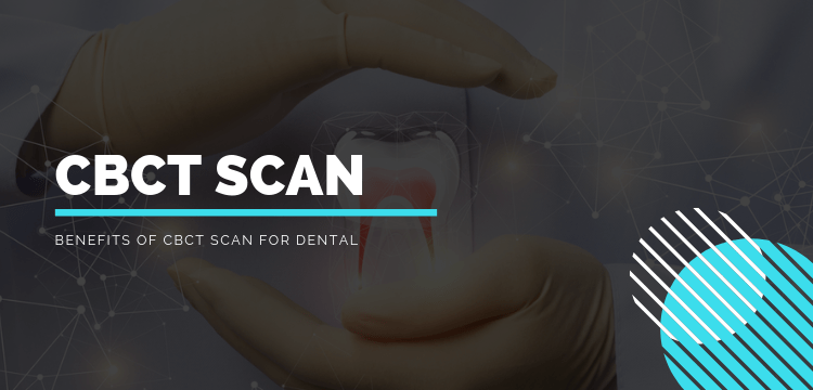 Benefits of CBCT scan for Dental