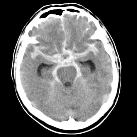 Eric Sussman, MD awarded the 2019 Joe Niekro Foundation...