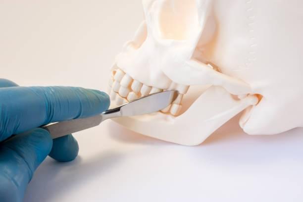 Maxillofacial Surgery in Salem: Expert Care at VIMS Hos...