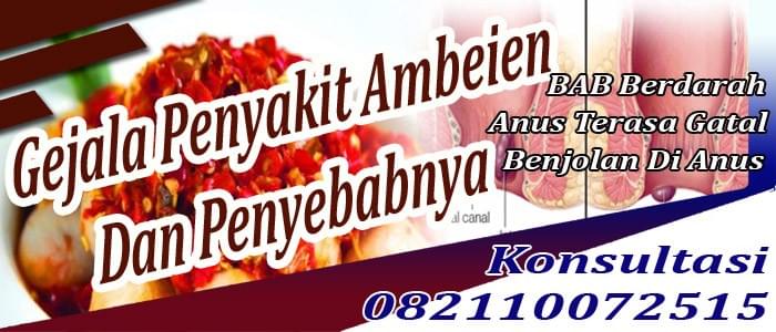Gejala Penyakit Ambeien Dan Penyebabnya - penyakit ambe...