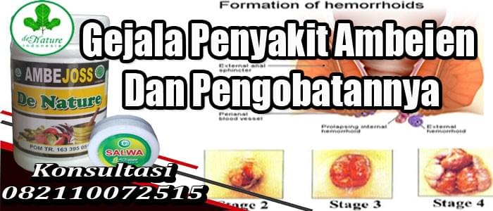 Gejala Penyakit Ambeien Dan Pengobatannya - cara mengat...