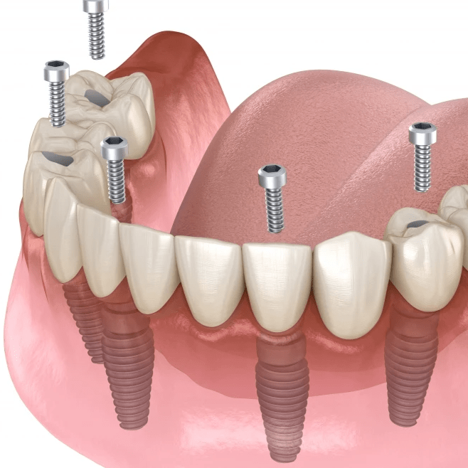 Valley Oak Oral Surgery - Oral Surgeon Fresno