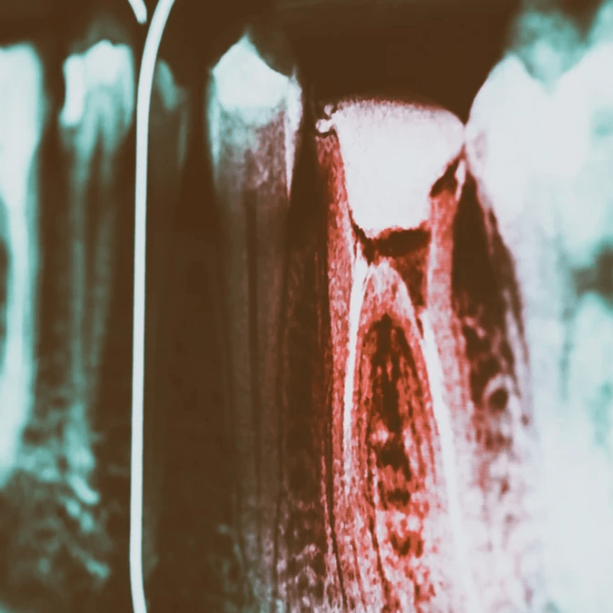 H.S. Mann Family Dentistry - Dentist in Sanger, CA