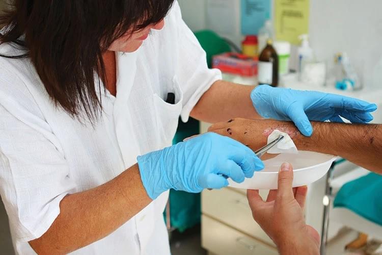All About Open Wounds - Types, Treatment & Complication...