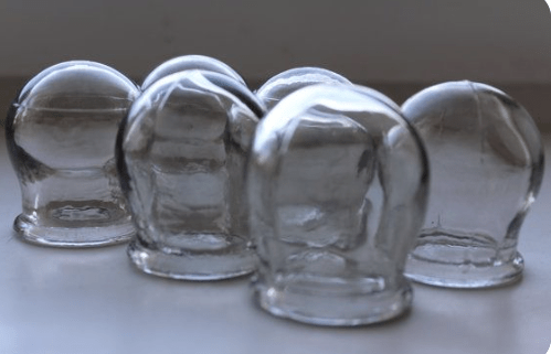 Bankes or באַנקעס