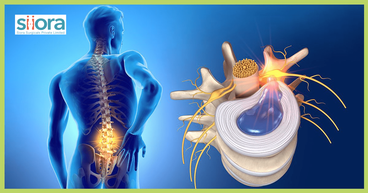 Thoracic Disc Herniation - A Quick Guide - Health ortho...