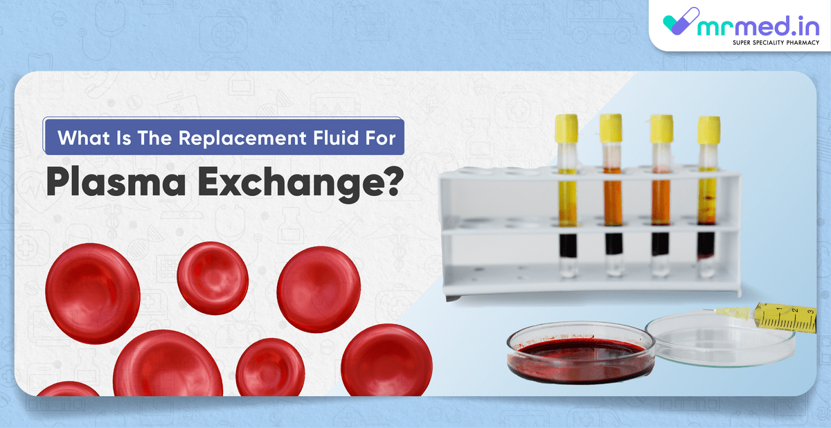 What Is the Replacement Fluid for Plasma Exchange?