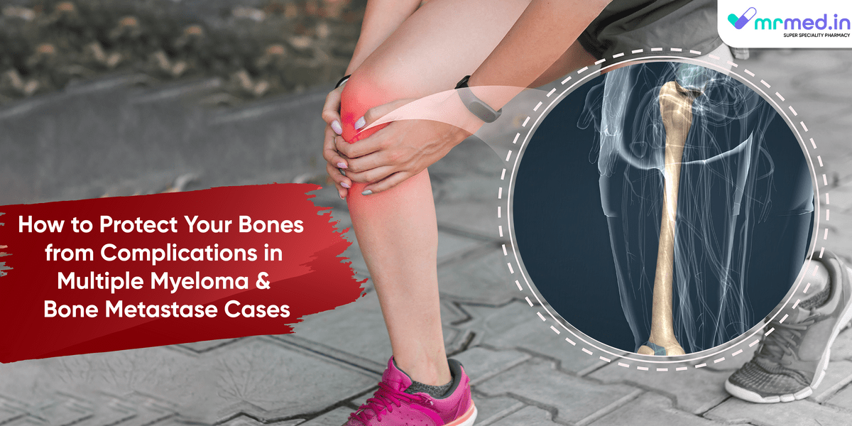 How to Protect Your Bones from Complications in Multipl...