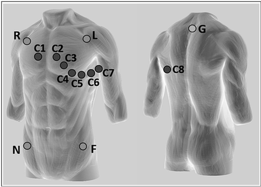 UHF-ECG Mapping - VDI Technologies