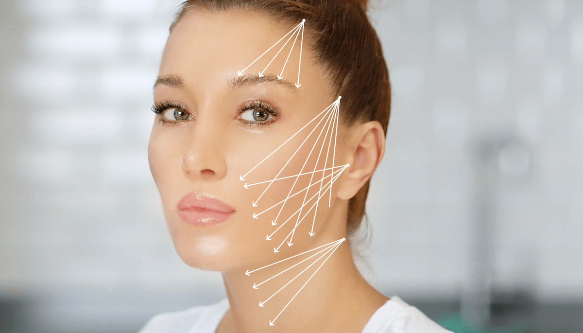 Lifting naturel : découvrez comment le fil tenseur Infi...