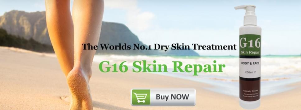Cost Effective Best Dry Skin Cream Online - G16 Lotion