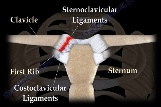 Sternocalvicular Joint Dislocations - collarbone disloc...