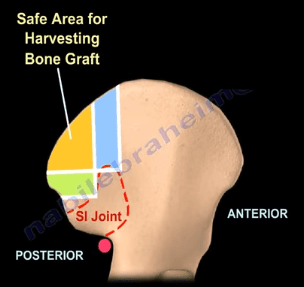 Structures That Pass Through the Greater Sciatic Notch ...