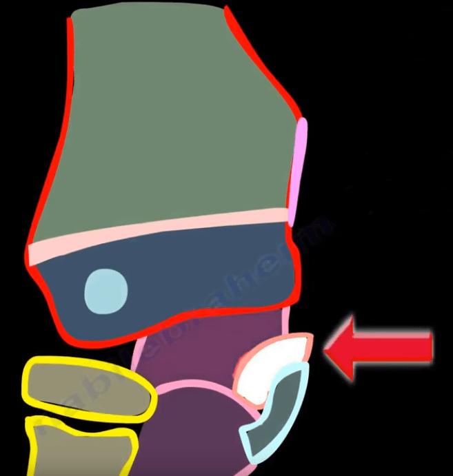 Pediatric Elbow Dislocation - Orthopedic Surgery Elbow ...