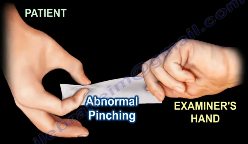 Froment’s Sign - Orthopedics Hand Nerve Injury Nabil Eb...