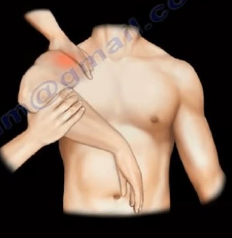 drop arm test indicates