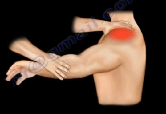 Clinical Examination of Shoulder and Rotator Cuff - Ort...
