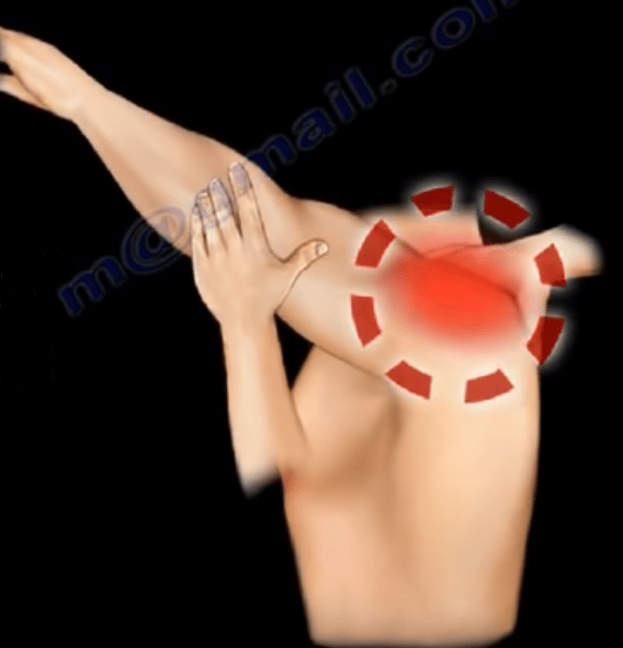 neer test rotator cuff